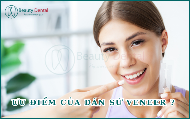 DÁN SỨ VENEER CÓ BỀN KHÔNG? LỜI KHUYÊN TỪ CHUYÊN GIA - Beauty Dental