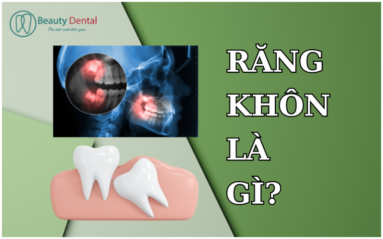 8 DẤU HIỆU MỌC RĂNG KHÔN BẠN CẦN LƯU Ý - Beauty Dental